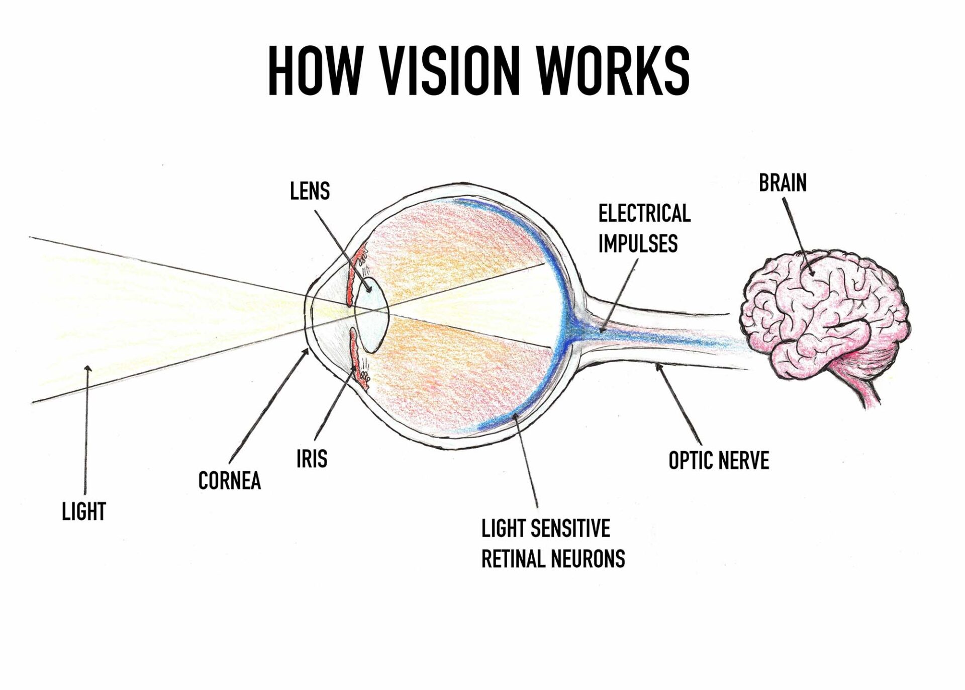 Can lost vision be restored?